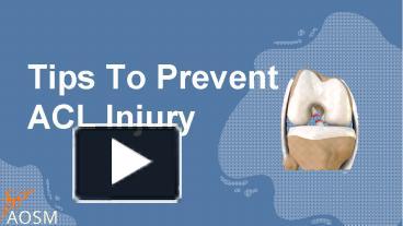 Tips To Prevent ACL Injury presentation | free to download