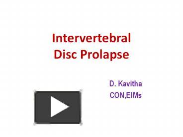 IVDP presentation | free to download