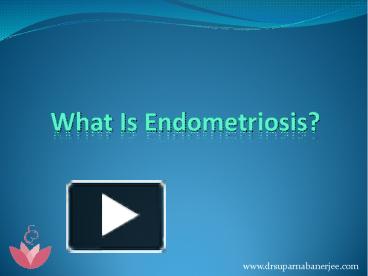 PPT – What are the different types of Endometriosis? PowerPoint ...