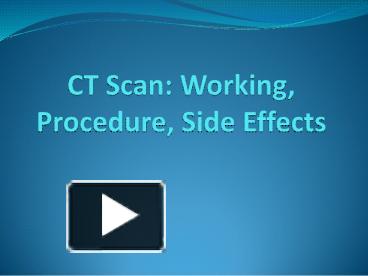PPT – CT Scan : Safety and Side Effects PowerPoint presentation | free ...
