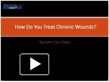PPT – Treat Chronic Wounds PowerPoint presentation | free to download ...