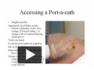 Accessing a Port-a-cath presentation | free to view