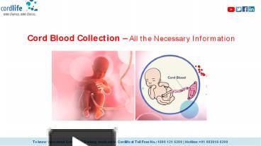 PPT – Cord Blood Collection – All the Necessary Information PowerPoint ...
