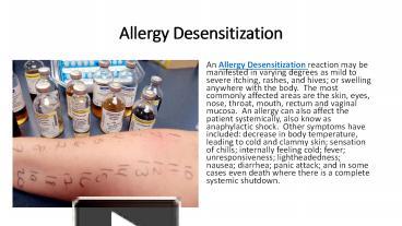 PPT – Allergy desensitization near me PowerPoint presentation | free to ...