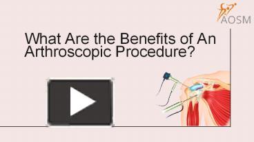 PPT – What Are the Benefits of An Arthroscopic Procedure? PowerPoint ...