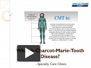 Charcot-Marie-Tooth Disease (CMT) - Symptoms, Causes, and Treatment ...