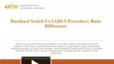 PPT – Duodenal Switch Vs SADI-S Procedure PowerPoint presentation ...