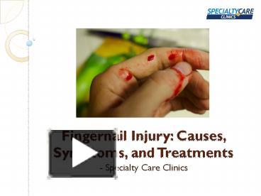 PPT – Fingernail Injury: Causes, Symptoms, Risk Factor and Treatments ...