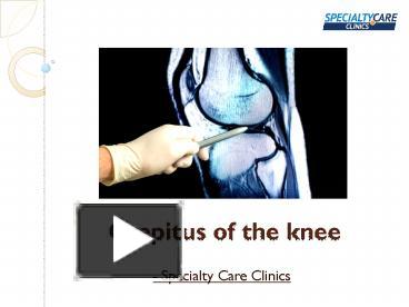 PPT – Unusual Knee Popping or Cracking: Crepitus PowerPoint ...