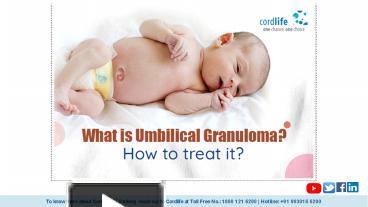 What Is Umbilical Granuloma? How To Treat It? (1) presentation | free ...