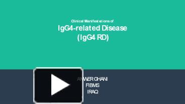 Clinical Manifestations of IgG4-related Disease (IgG4 RD) presentation ...