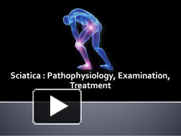Sciatica : Pathophysiology, Examination, Treatment presentation | free ...
