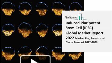 Induced Pluripotent Stem Cell (IPSC) Market 2022-2026 | Global Share ...