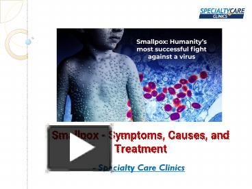 Smallpox - Symptoms, Causes, and Treatment presentation | free to download