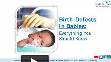 PPT – Birth Defects In Babies: Everything You Should Know PowerPoint ...