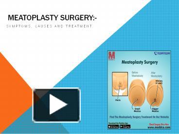 meatoplasty surgery presentation | free to download
