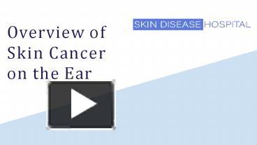 Complete guide about skin cancer on the ear presentation | free to download