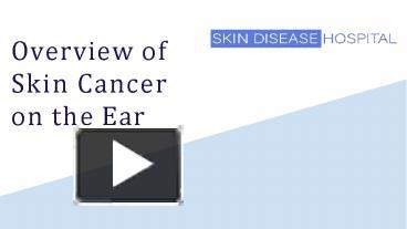 Skin cancer on the ear - Learn more! presentation | free to download