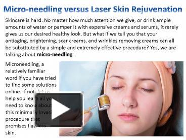 PPT – Micro-needling versus Laser Skin Rejuvenation PowerPoint ...