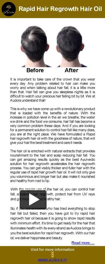 PPT – Rapid Hair Regrowth Hair Oil PowerPoint presentation | free to ...