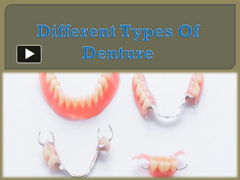 Different Types Of Denture presentation | free to download
