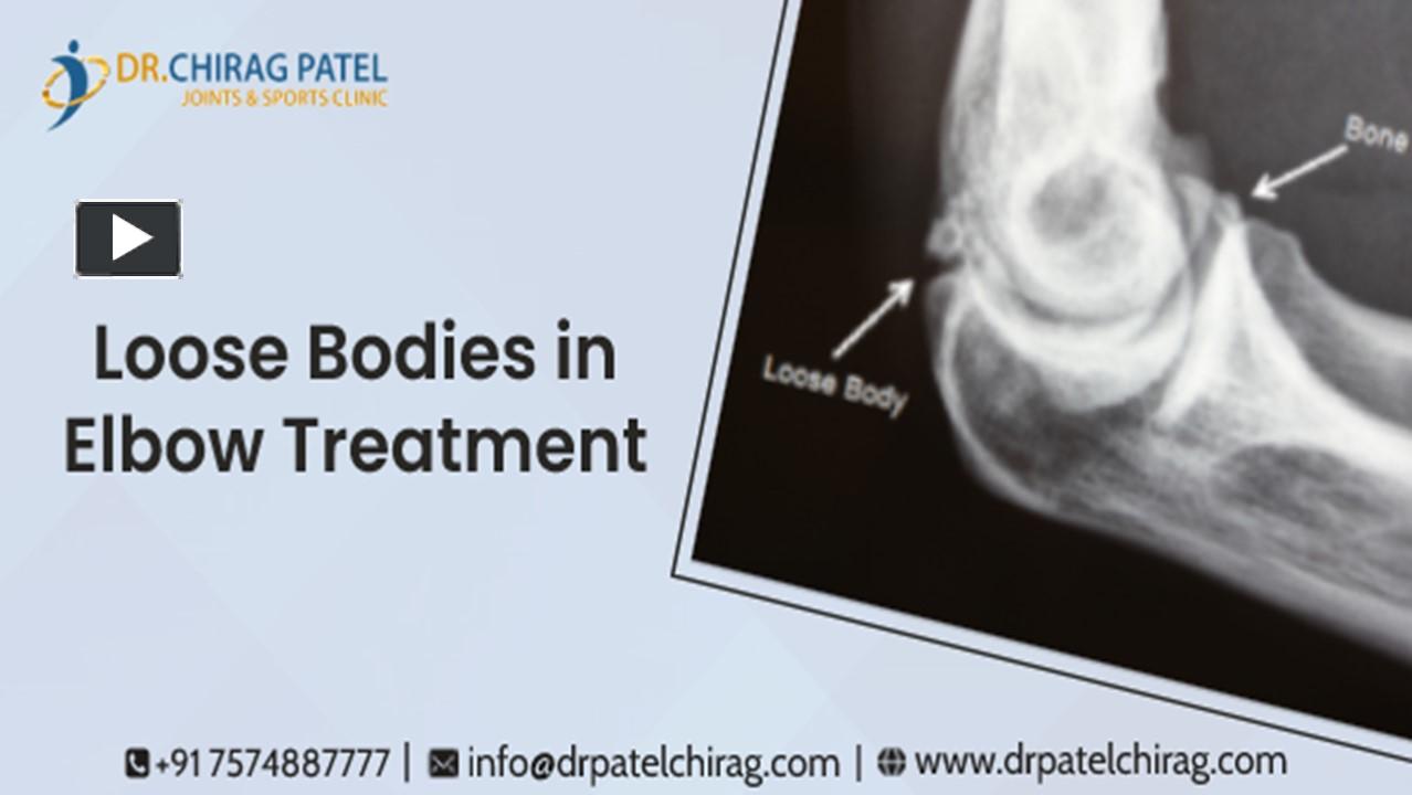 PPT – Loose Bodies Removing From the Joint Surgery| Elbow Arthroscopy ...