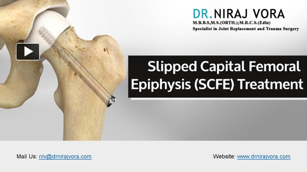 Slipped Capital Femoral Epiphysis (SCFE) Treatment | Dr Niraj Vora ...