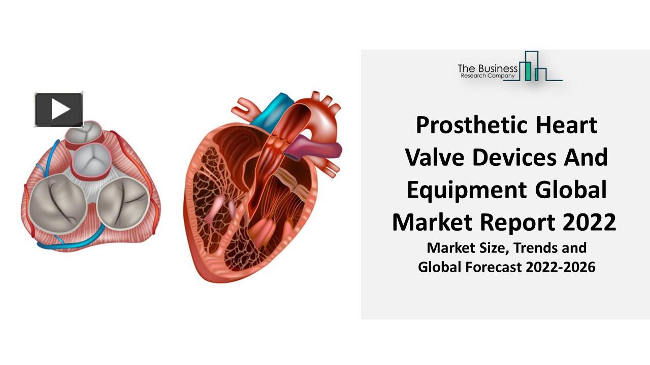 Prosthetic Heart Valve Devices And Equipment Market 2022 : Industry ...