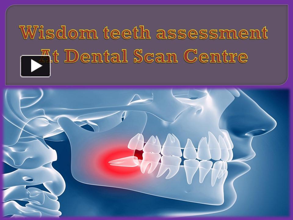 PPT – Wisdom teeth assessment At Dental Scan Centre PowerPoint ...