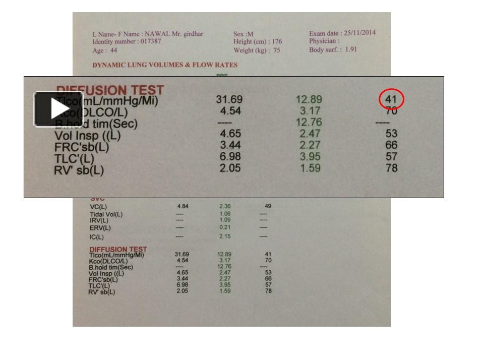 PPT – Pulmonary function tests Diffusion study Steps to diagnose ILD ...
