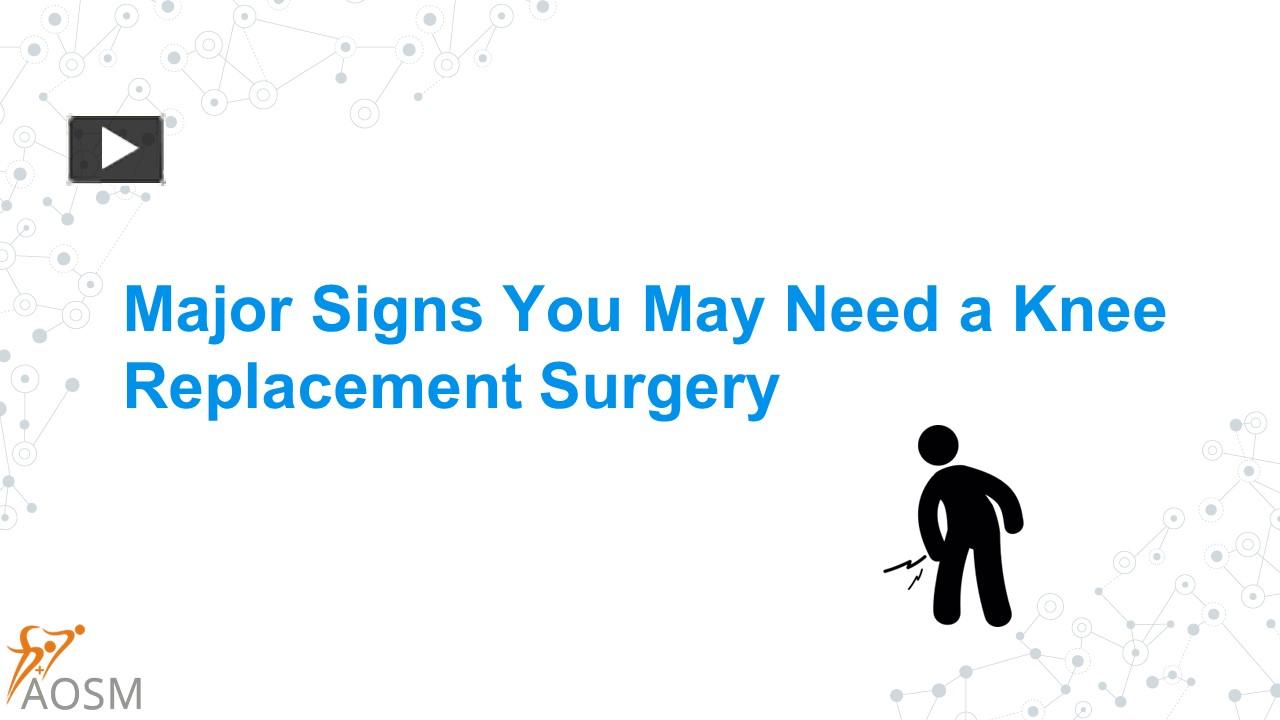 Major Signs You May Need a Knee Replacement Surgery presentation | free ...
