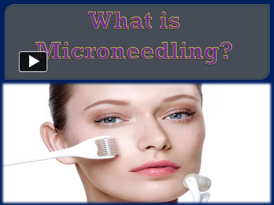 PPT – What is Microneedling? PowerPoint presentation | free to download ...