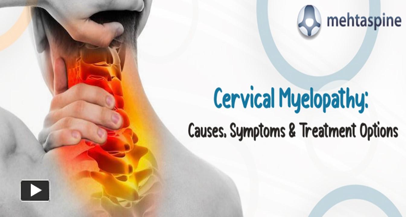 Cervical Myelopathy: Causes, Symptoms & Treatment Options presentation ...