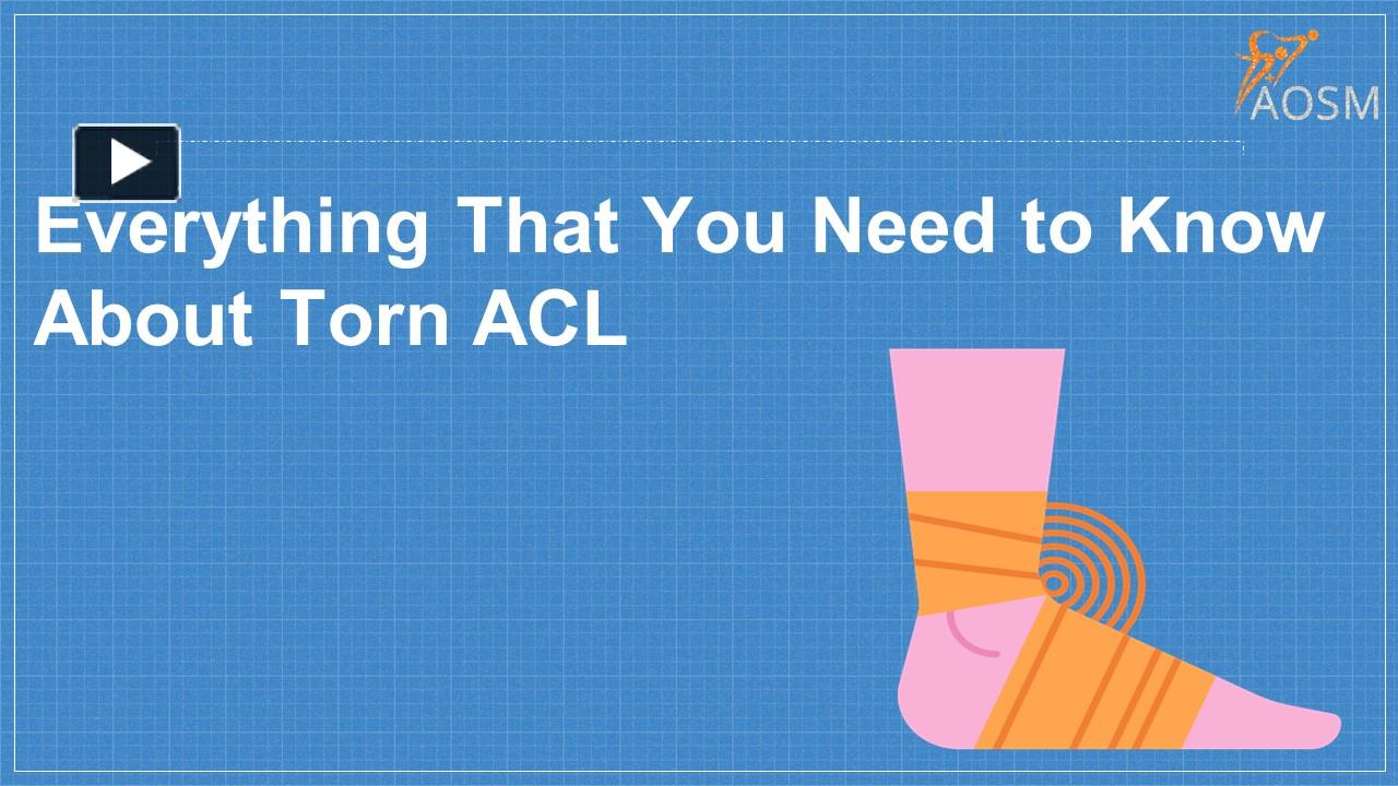 PPT – Everything That You Need to Know About Torn ACL PowerPoint ...