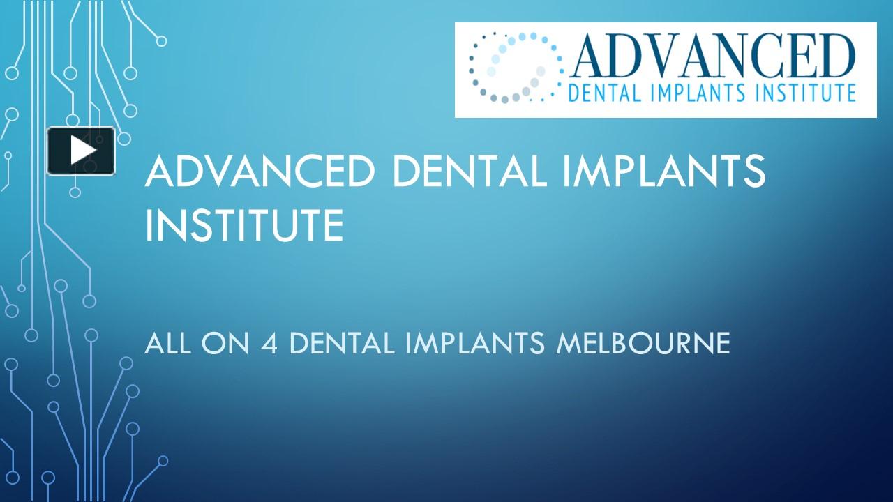 All On 4 Dental Implants Melbourne 2 Presentation Free To Download