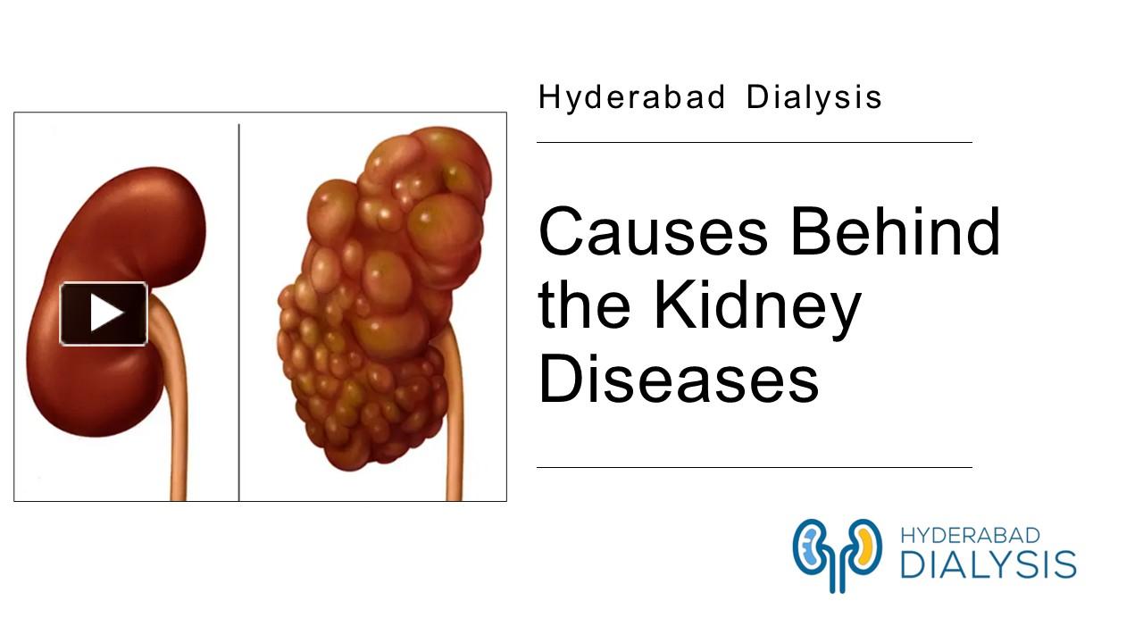 PPT – Chronic Kidney Disease Treatment PowerPoint presentation | free ...