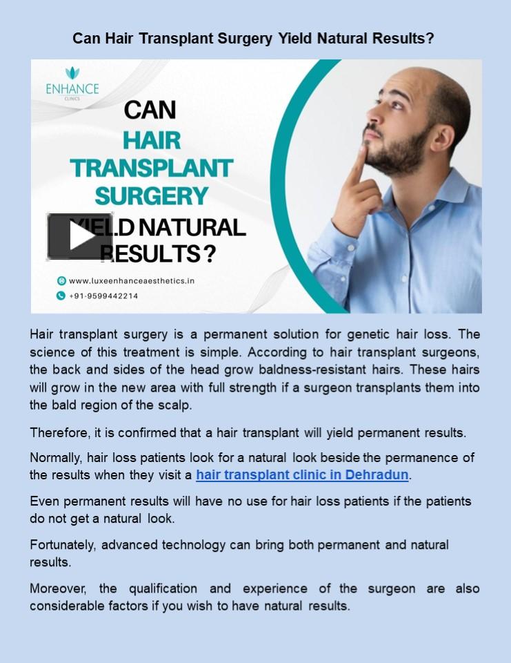 PPT – Can Hair Transplant Surgery Yield Natural Results? PowerPoint ...