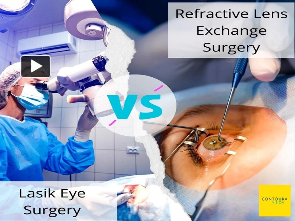 Lasik vs Refractive Lens Exchange Surgery presentation | free to download