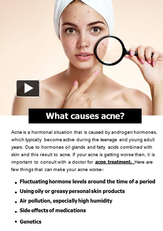 What causes acne? presentation | free to download