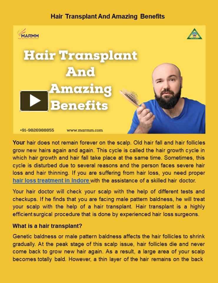 PPT – Hair Transplant And Amazing Benefits PowerPoint presentation ...