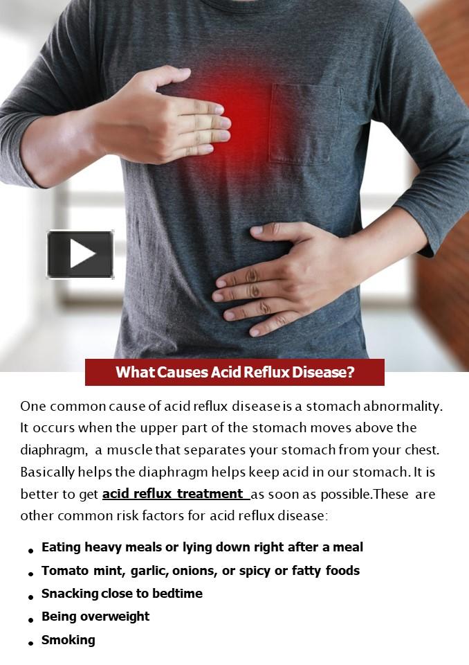 PPT – What Causes Acid Reflux Disease? PowerPoint presentation | free ...