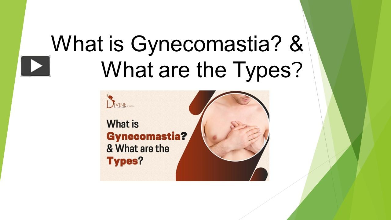 What is Gynecomastia & What are the Types presentation | free to download