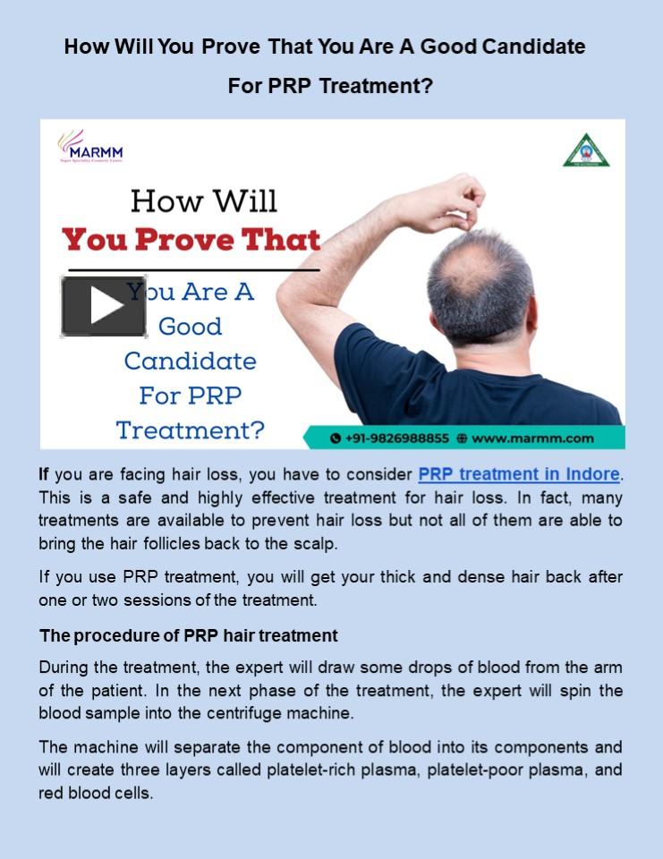 How Will You Prove That You Are A Good Candidate For PRP Treatment ...