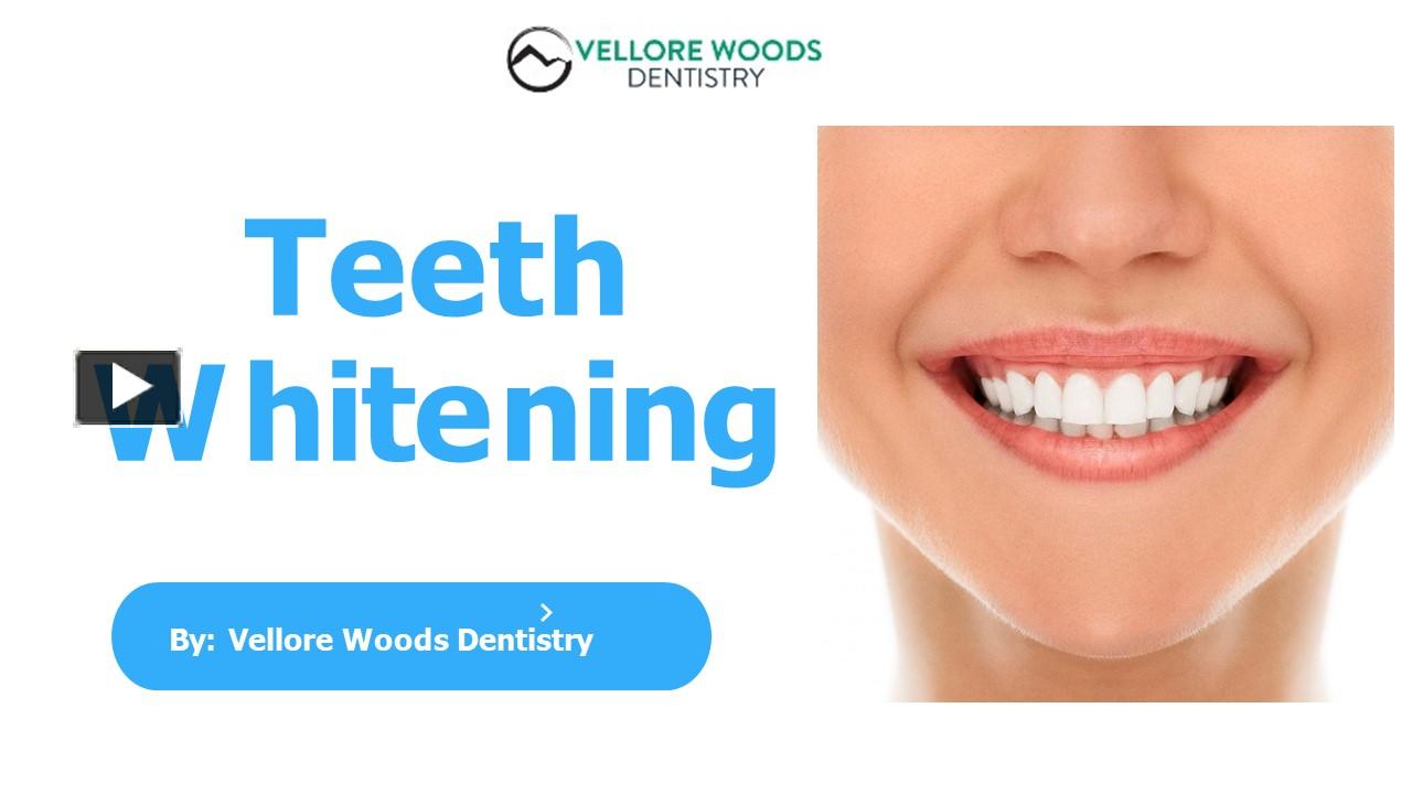 PPT – All You Need to Know About Teeth Whitening (1) PowerPoint ...