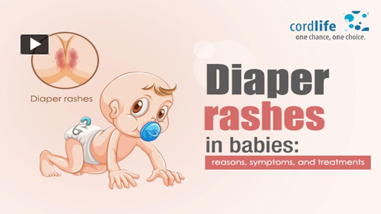 Diaper Rashes In Babies: Reasons, Symptoms and Treatments presentation ...