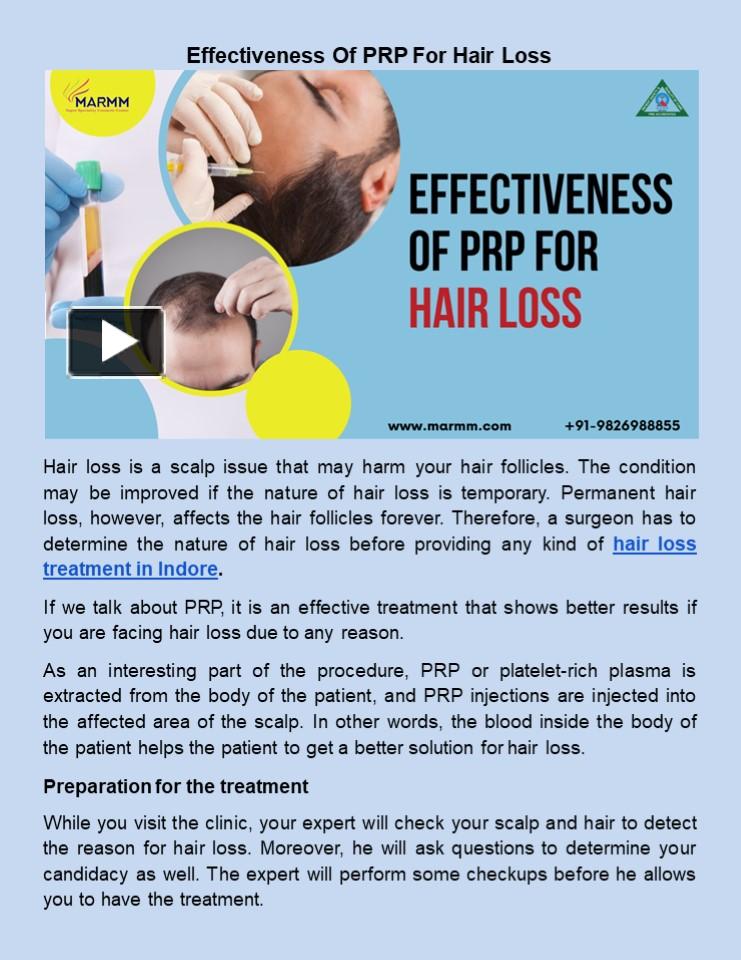 PPT – Effectiveness Of PRP For Hair Loss PowerPoint presentation | free ...