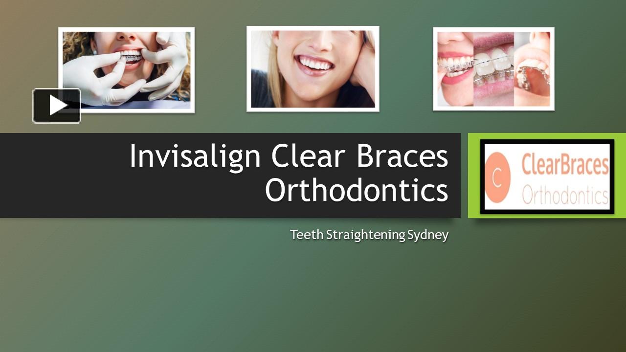 PPT – Best Invisalign Center in Sydney That Offers Best Price for ...