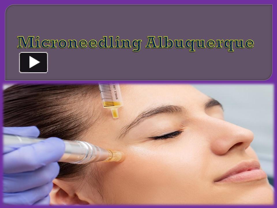 PPT – Microneedling Albuquerque PowerPoint presentation | free to ...
