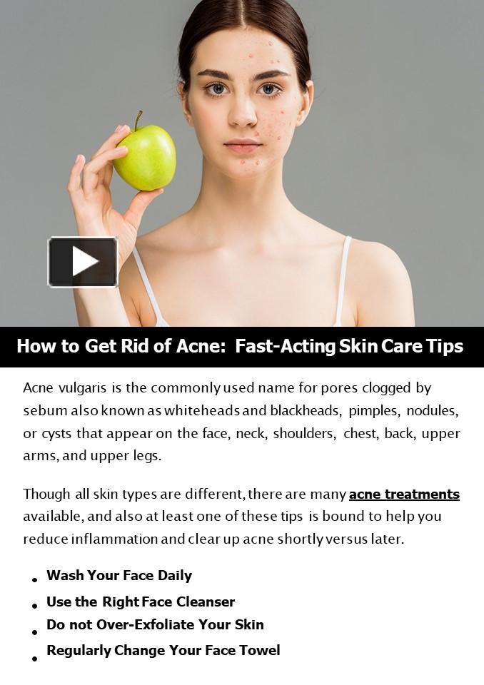 PPT – How to Get Rid of Acne: Fast-Acting Skin Care Tips PowerPoint ...