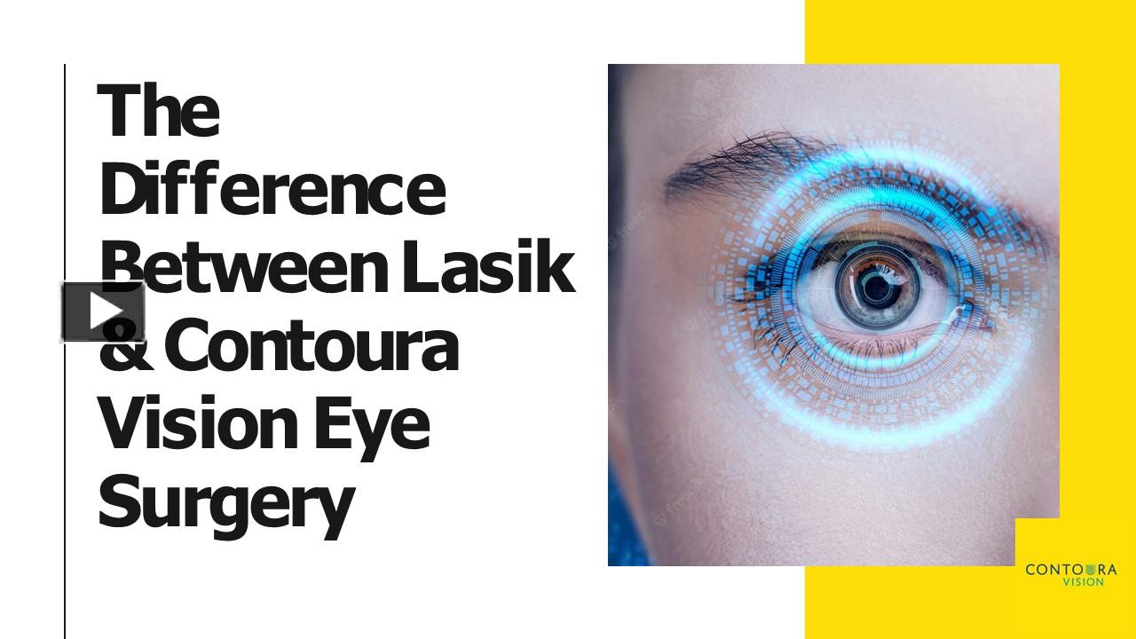 PPT – Difference Between Lasik and Contoura Vision PowerPoint ...
